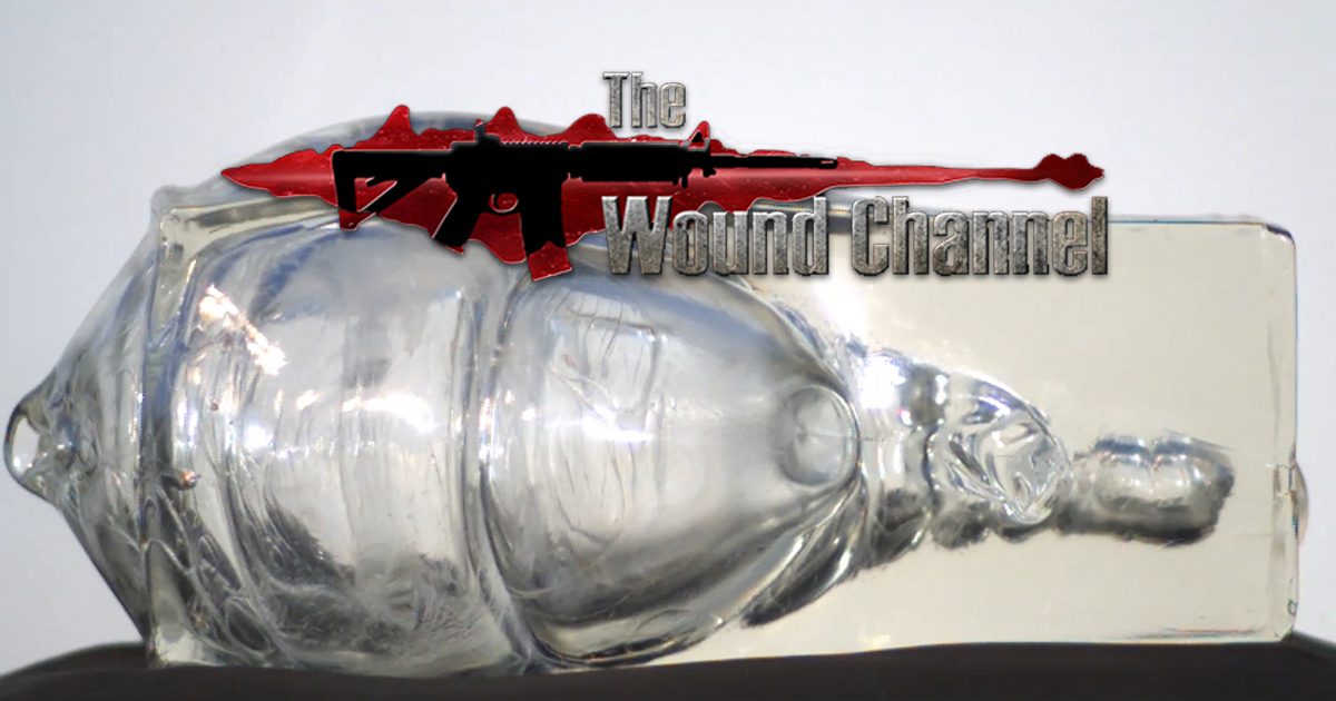 The Wound Channel